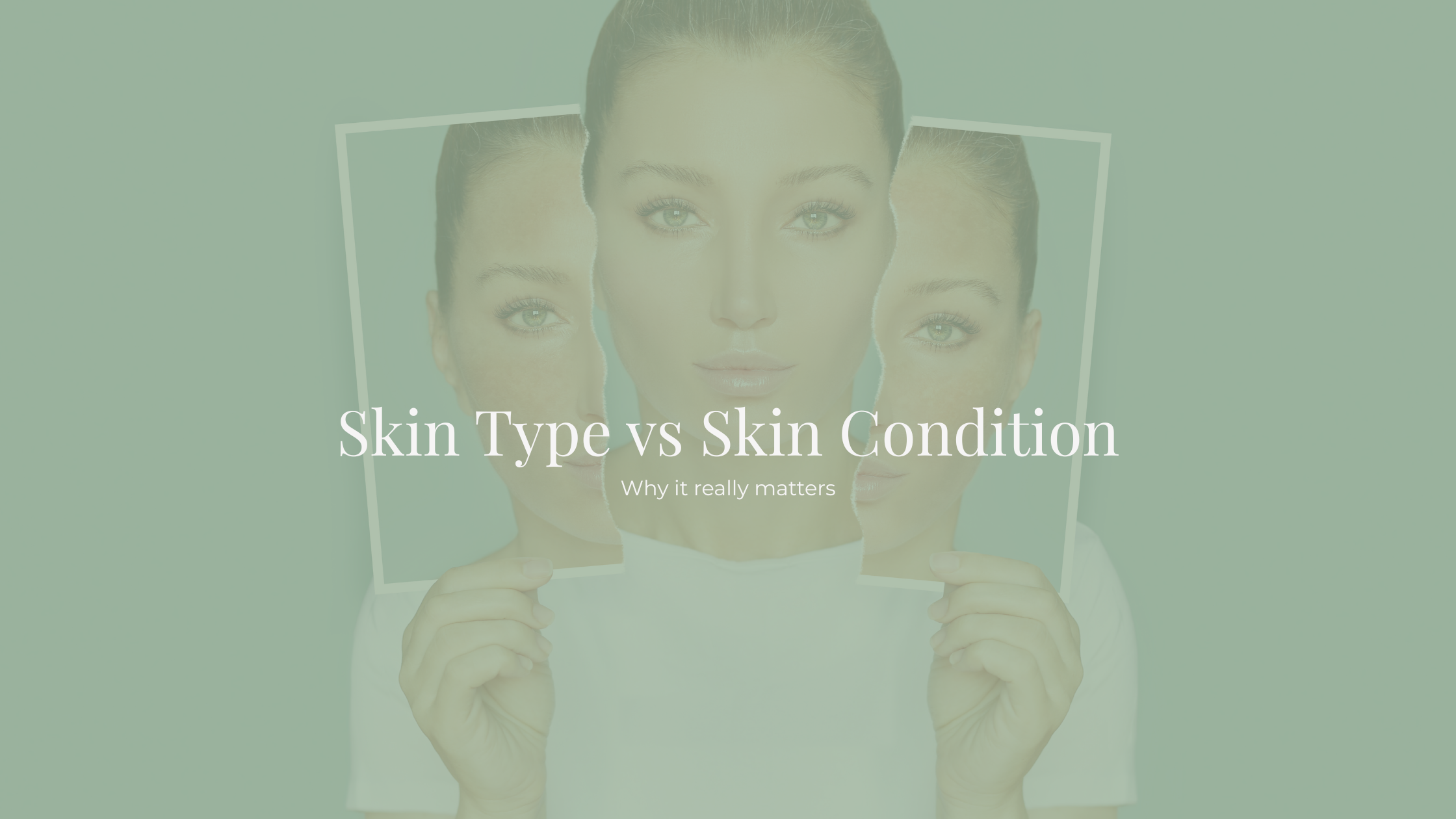Do You Know Your Skin Type? Here’s Why It Matters – The Shed Diaries